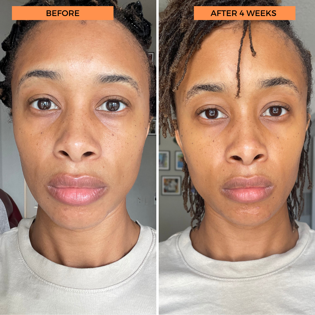 Universal C Eye Perfector Vitamin C Eye Cream - Beautystat – BeautyStat